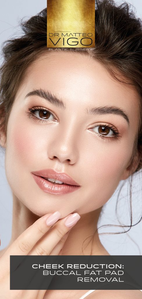Buccal Fat Pad Removal Dubai | Dr. Matteo Vigo - Plastic ...